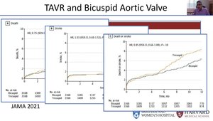 Optimization of TAVR: Best Practice, Patient Selection, and Outcome Improvements | VuMedi