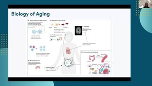 Can Do Multiple Sclerosis | VuMedi