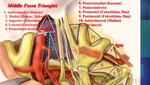 Middle Fossa Approach: Technical Nuances and Applications | Vumedi