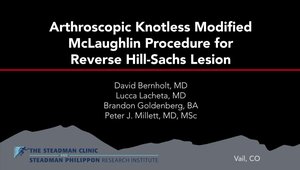 Arthroscopic Knotless Modified McLaughlin Procedure for Reverse Hill ...