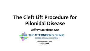 The Cleft Lift Procedure For Pilonidal Disease, Case with Sinus and ...