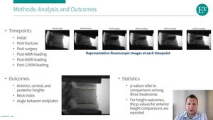 Bilateral Vertebral Augmentation Systems for Vertebral Compression ...