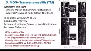 ECTRIMS 2024 Insights: Clinical Spectrum of MOG Antibody-Associated ...