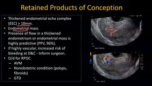 Early Pregnancy Ultrasound First Trimester Normal Appearances And