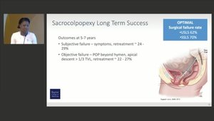 Native Tissue Approaches for Pelvic Organ Prolapse: What’s New? | Vumedi