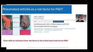 AHA 2024 Insights: Peripheral Arterial Disease (PAD), the Cinderella of ...