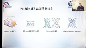 Transcatheter Pulmonary Valve Replacement: It's Not Like the Aortic ...