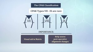Knee Alignment Series Video 4: The Principles of CPAK | Vumedi