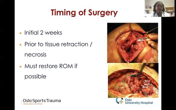 Acute PLC with ACL Injuries | Vumedi