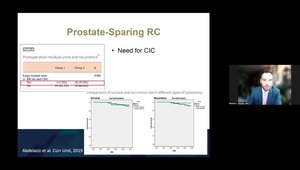 2024 Update in Male Radical Cystectomy | Vumedi
