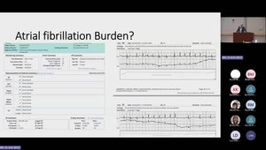Atrial Fibrillation- Refractory Atrial Fibrillation in the Elderly: How ...
