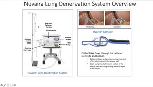 Targeted Lung Denervation for Moderate to Severe COPD: Procedure ...