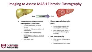 Highlights from AASLD Guideline for Diagnosis and Management of MASLD ...