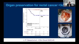 ASCO GI 2023 Final Surgical Salvage Results From OPERA Phase 3 ...