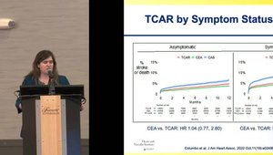 Carotid Stenosis: TCAR Should Be Considered First-Line Therapy | Vumedi