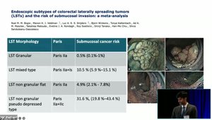 Endoscopic Resection of Large Colonic Polyps | Vumedi
