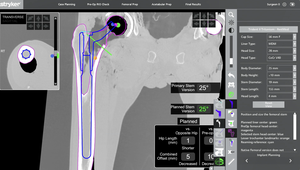 Reimagining Revision Hips: Mako Total Hip Direct Anterior Approach | Vumedi