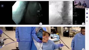 Live EGD with Esophageal Stent Placement | Vumedi