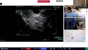 Live EUS and ERCP with Pancreatoscopy | Vumedi