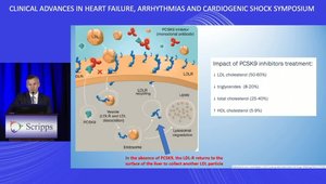 Lipids Update: Overview of Current Guidelines for Lipid Management | Vumedi