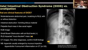 Cystic Fibrosis for the General Pulmonologist: DIOS, Sinusitis and ...