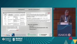 How to Perfectly Plan and Execute a Derotational Osteotomy Around the ...