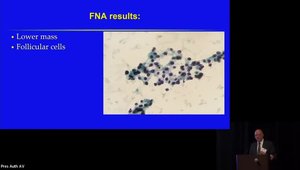 Unmet Needs in Parathyroid Surgery: Diagnosis, Localization ...