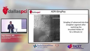 Re-Entry Devices Best Practices: STING RAY, Recross, and Others | Vumedi