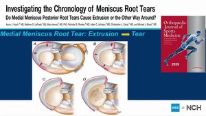 Medial Meniscus Root Repair and Role of Centralization | Vumedi