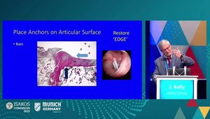 Remplissage in Shoulder Instability | Vumedi