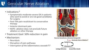 Optimizing Genicular Nerve Ablation: Patient Selection and Procedural ...