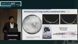 Ultra-Wide Field OCT: Principles, Imaging Angles, and Peripheral ...