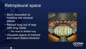 Lateral Corpectomy: Thoracolumbar Junction and Beyond | Vumedi