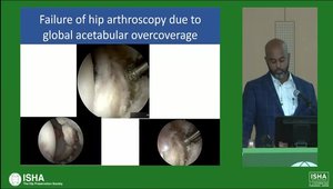 Approach to Failed Hip Arthroscopy: Evaluation of Causes and Approach ...
