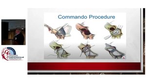 Commando Procedure: 30 Years in the Making | Vumedi