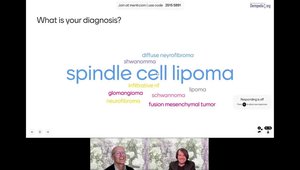 NOT DFSP! Diffuse Neurofibroma with Honeycomb Fat Trapping in ...