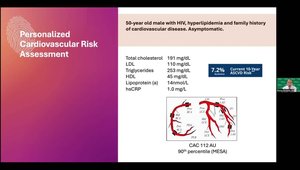 AI-Powered Plaque Quantification: Disruption of Cardiovascular ...