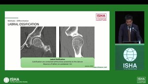 Acetabular Ossicles: Epidemiology and Correlation With FAI | Vumedi