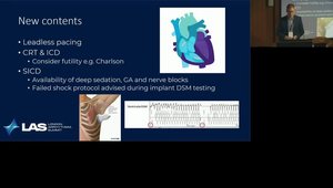 UK Pacemaker & ICD Guidance: Updates in Leadless Pacing, SICDs, and ...