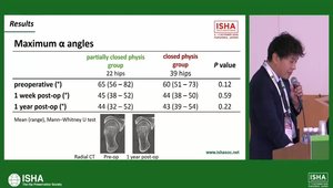 Impact of Cam Osteochondroplasty at Proximal Femoral Physeal Closure on ...