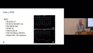 The Spectrum of Pulmonary Vascular Diseases | Vumedi