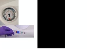 Dr. Marc Ribó: Interactive Case Presentation on Stroke | Vumedi