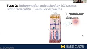48th Annual Macula Society Meeting Insights: Pathogenic Mechanisms of ...
