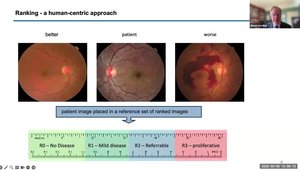 48th Annual Macula Society Meeting Insights | Vumedi