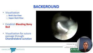 Long-term Outcomes of Advanced Arthroscopic Techniques for Patients ...