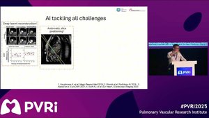 The Spectrum of Pulmonary Vascular Diseases | Vumedi