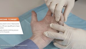 5th Finger 47º PIP Joint Contracture: Treatment and Technique | Vumedi