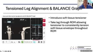 Robotic-Assisted Inverse Kinematic Alignment Simplified | Vumedi