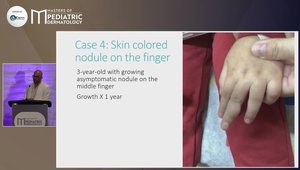 Recognition of Common and Not so Common Rashes in Children | Vumedi