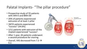 Primary Snoring | Vumedi